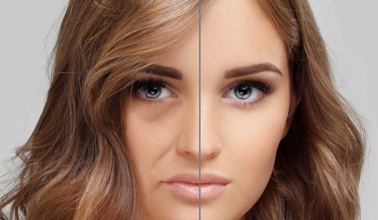 Midface 3 in 1 The best solution for facial | JW Korean Plastic Hospital