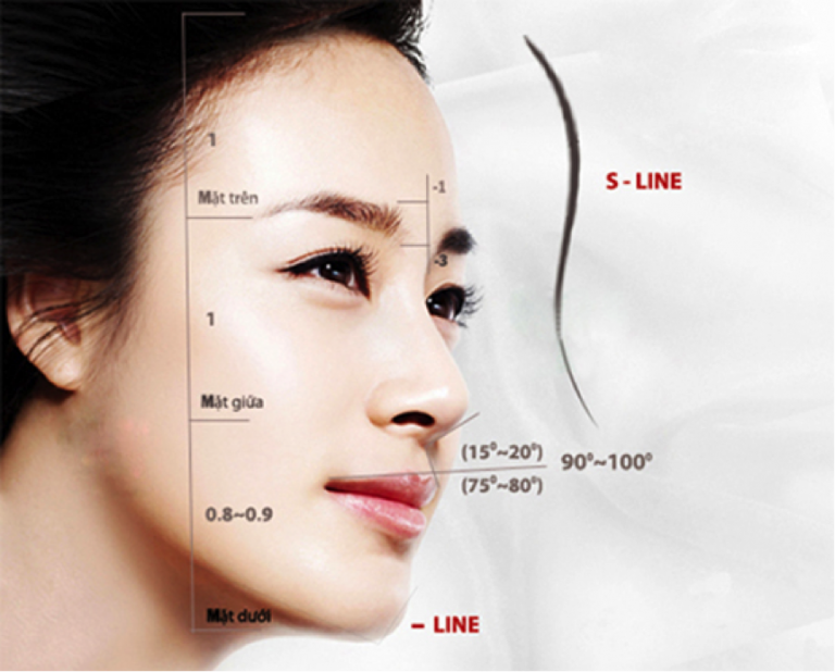 S Line Plus Rhinoplasty with standard Korean shape