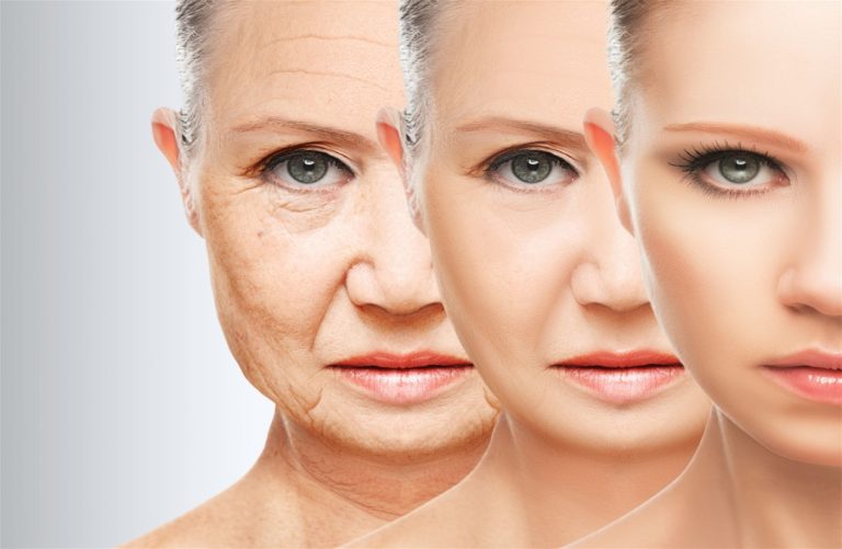 Rejuvenate your skin with just one SMAS facelift treatment